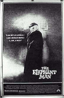 Pôster do filme O Homem Elefante - Foto 38 de 38 - AdoroCinema